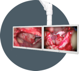 Surgical Products - Operating Theatre Tables I Hipac Healthcare