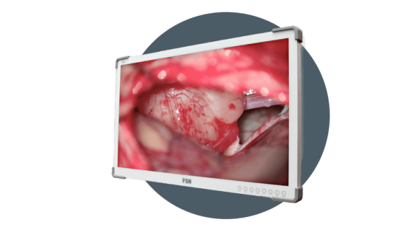 Medical Grade Displays | Hipac Healthcare